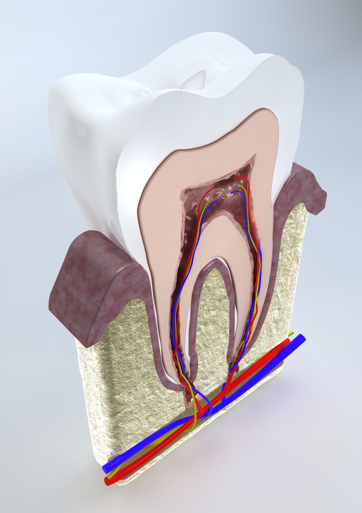 Parodontologija | Dental centar Miletić | vratite osmijeh i pouzdanje